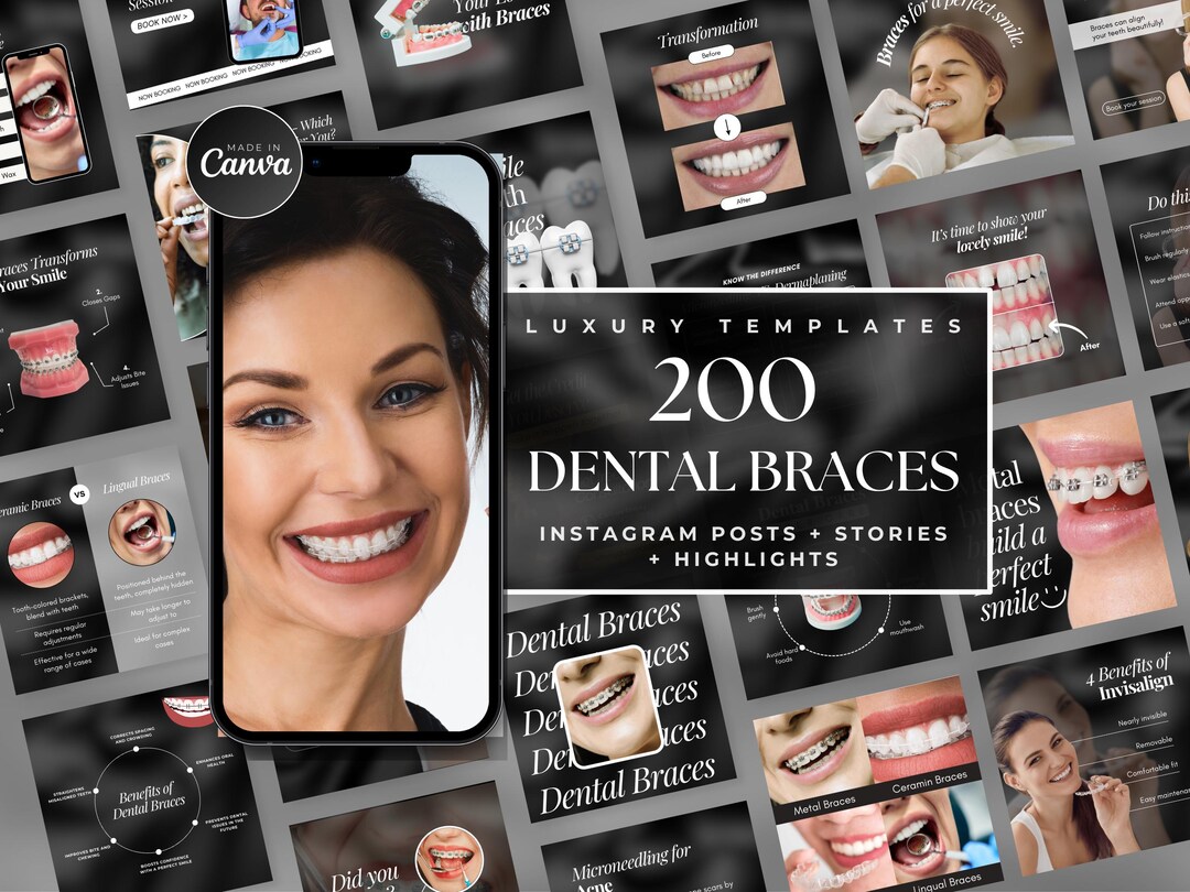 200 Dental Braces Instagram Templates | Luxury Black Dental Braces ...