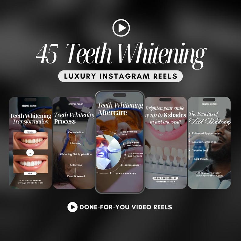 45 Teeth Whitening Instagram Video Reels | LED Teeth Whitening ...