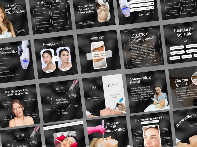 200 Microneedling Instagram Templates | Luxury Black Microneedling ...