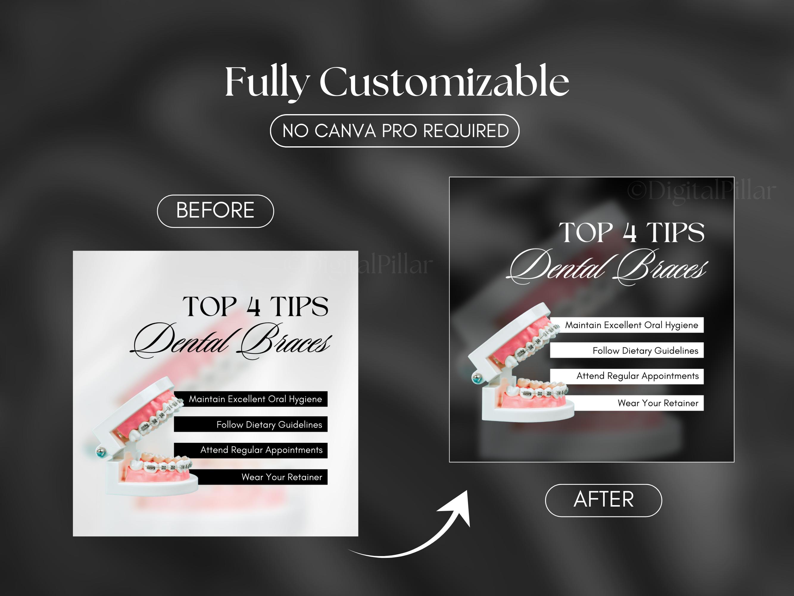 200 Dental Braces Instagram Templates | Orthodontist Instagram Posts ...