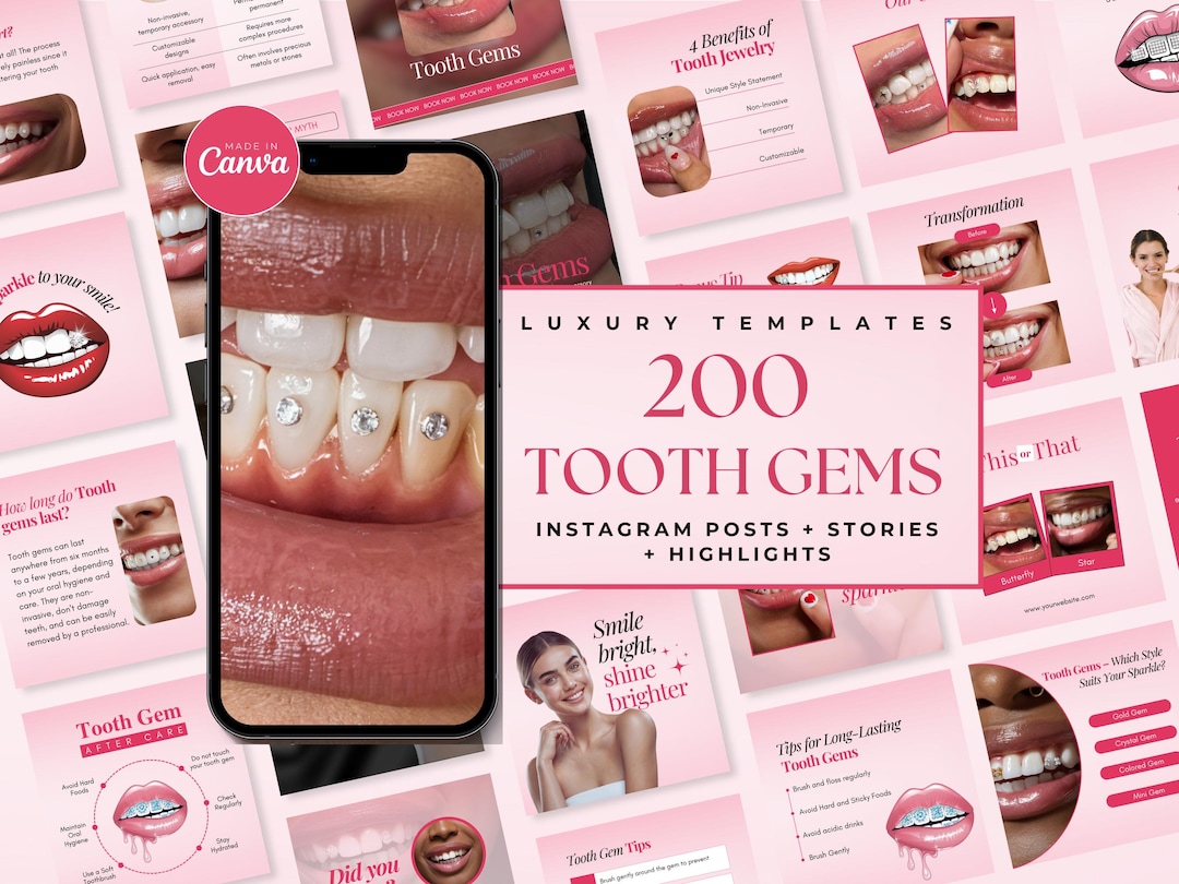 Pink Tooth Gem Instagram Templates | 200 Tooth Gem Instagram Post Pink ...