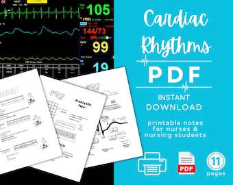 EKG & Dysrhythmia Interpretation Cardiac Rhythm Nursing School Notes ...