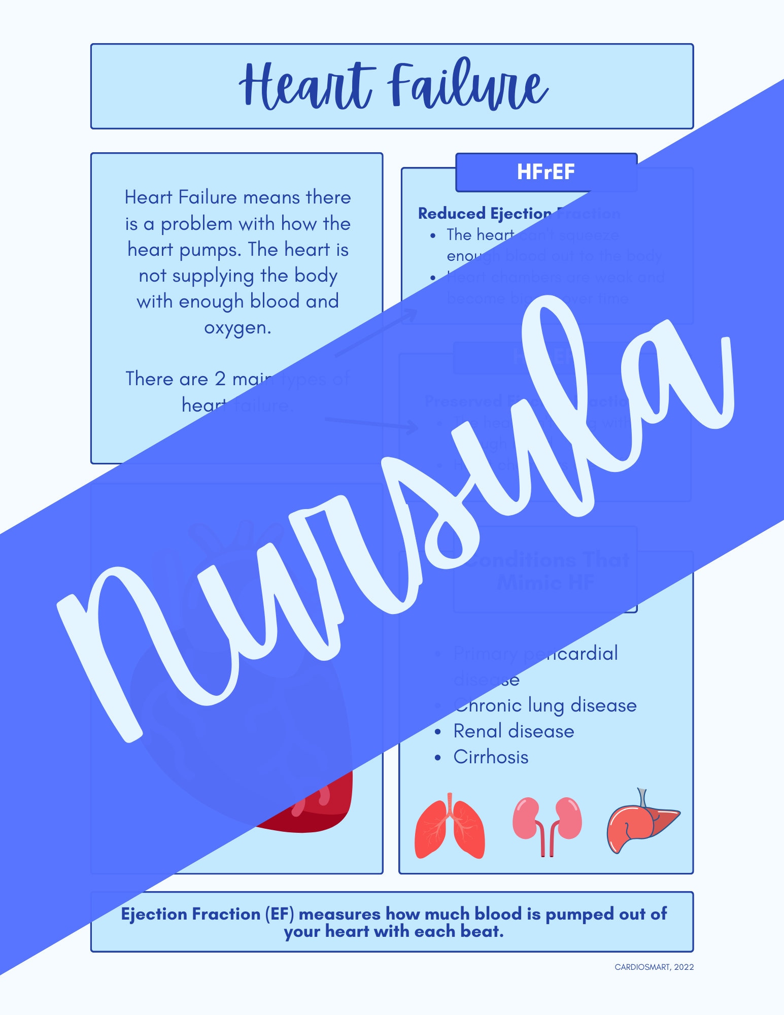 Heart Failure Notes - Etsy