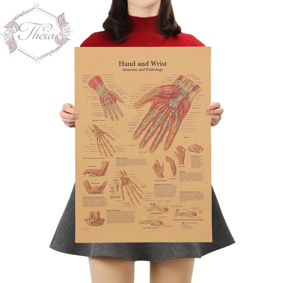 Hand and Wrist Anatomy and Pathology Vintage Retro Kraft Paper Poster ...