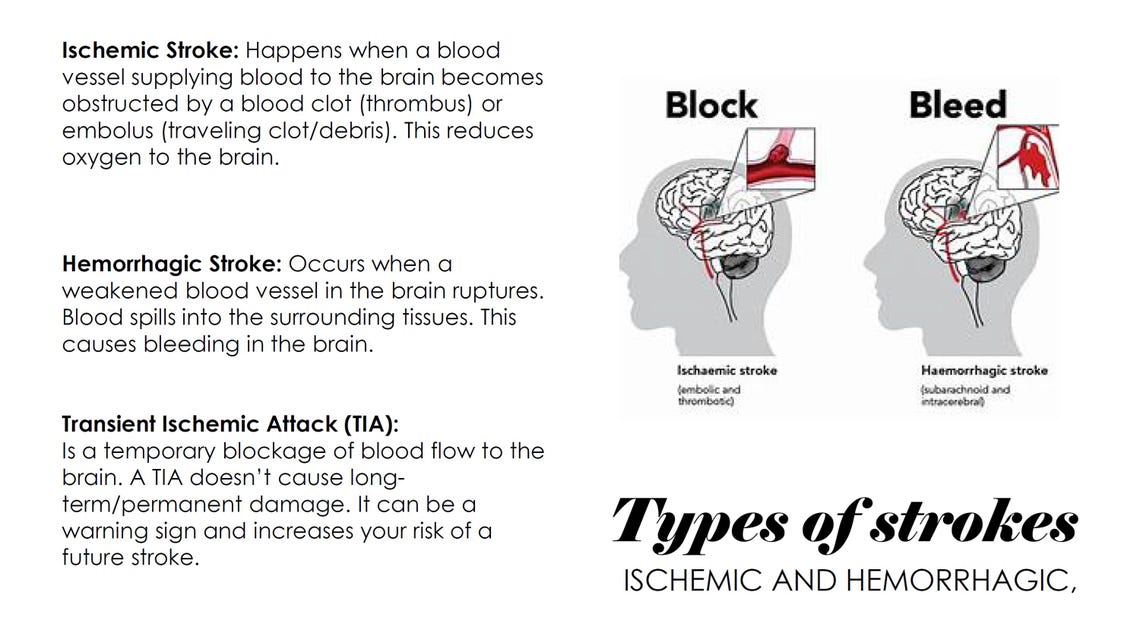 Types of Strokes Notes - Etsy