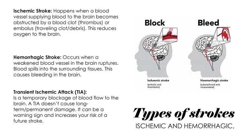Types of Strokes Notes - Etsy