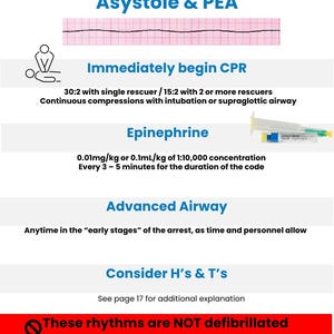 PALS Algorithm Cheat Sheets (based on the 2020 AHA PALS Updates ...