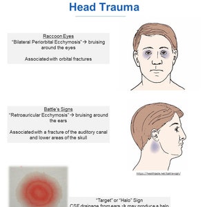 EMT Trauma Study Guide - Etsy
