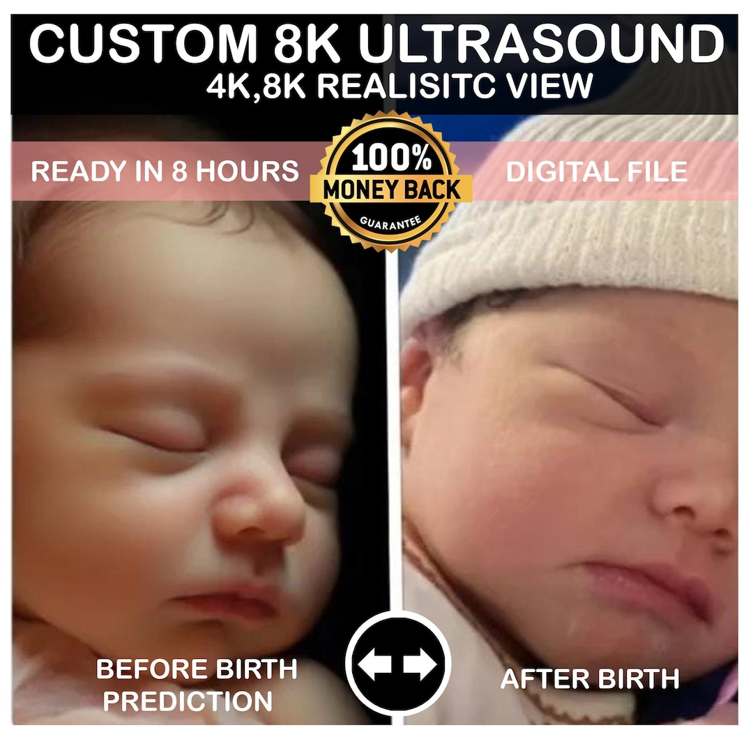 Ultrasound 8k Baby Image 3d 4d 5d 8d Real View Baby AI Photo ...