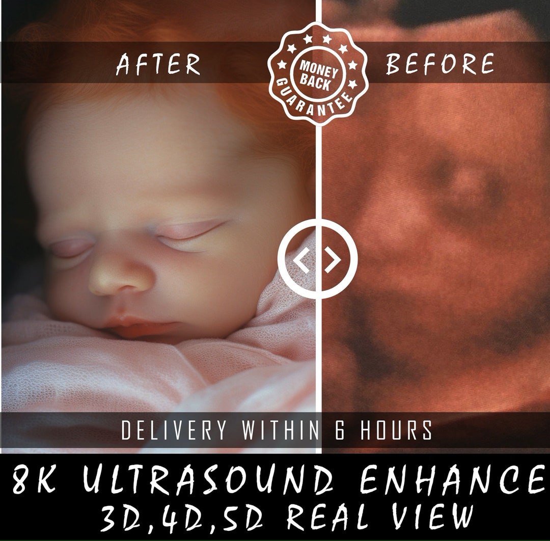 Ultrasound 8k Baby Image 3d 4d 5d 8d Real View Baby AI Photo ...