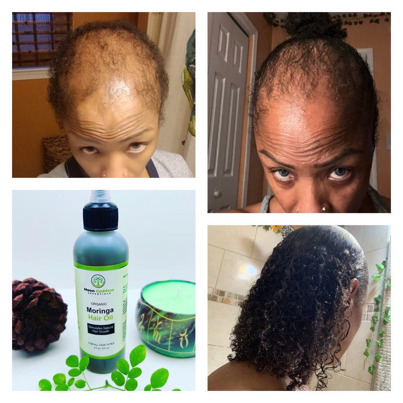 Moringa Hair Growth Oil 4oz. - Etsy