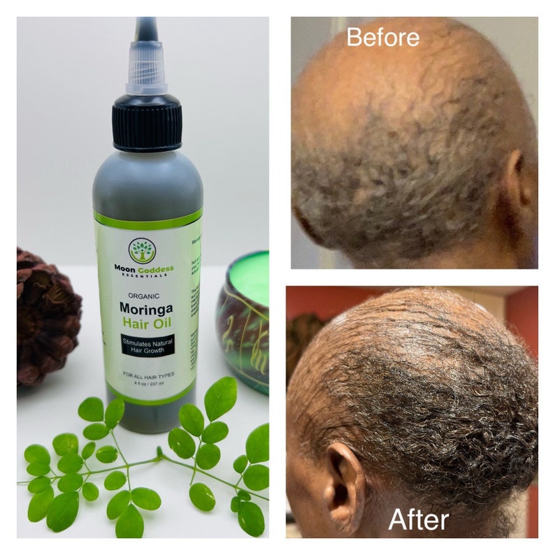 Moringa Hair Growth Oil 4oz. - Etsy