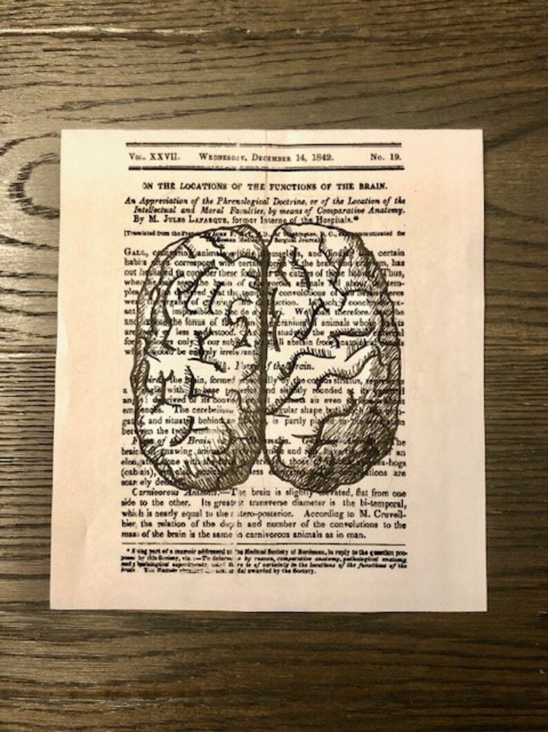 Anatomical Sketch of the Brain- Neurosurgeon/neurologist Gift, Medical ...