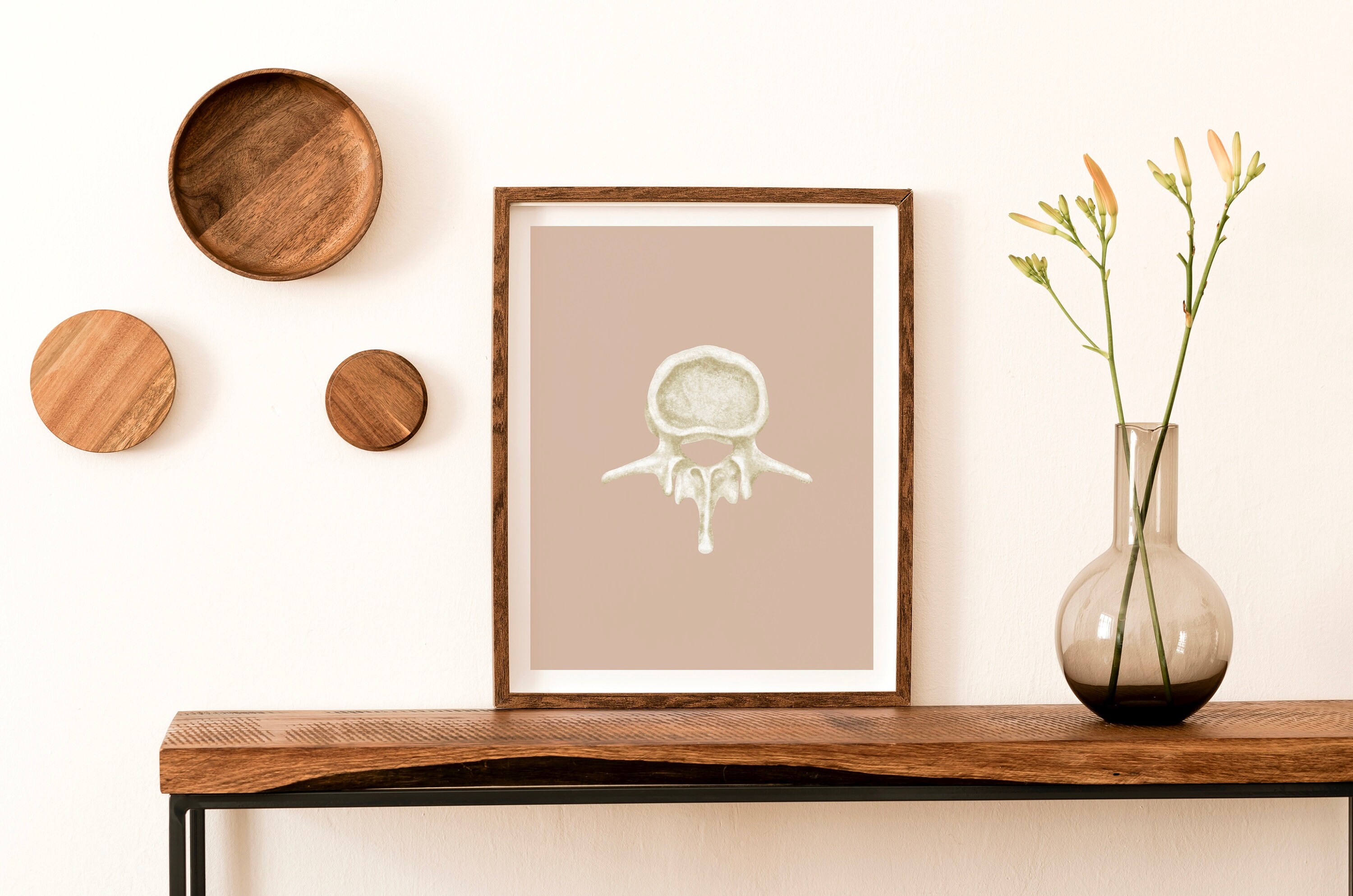 Lumbar Vertebrae Drawing Print Download - Etsy