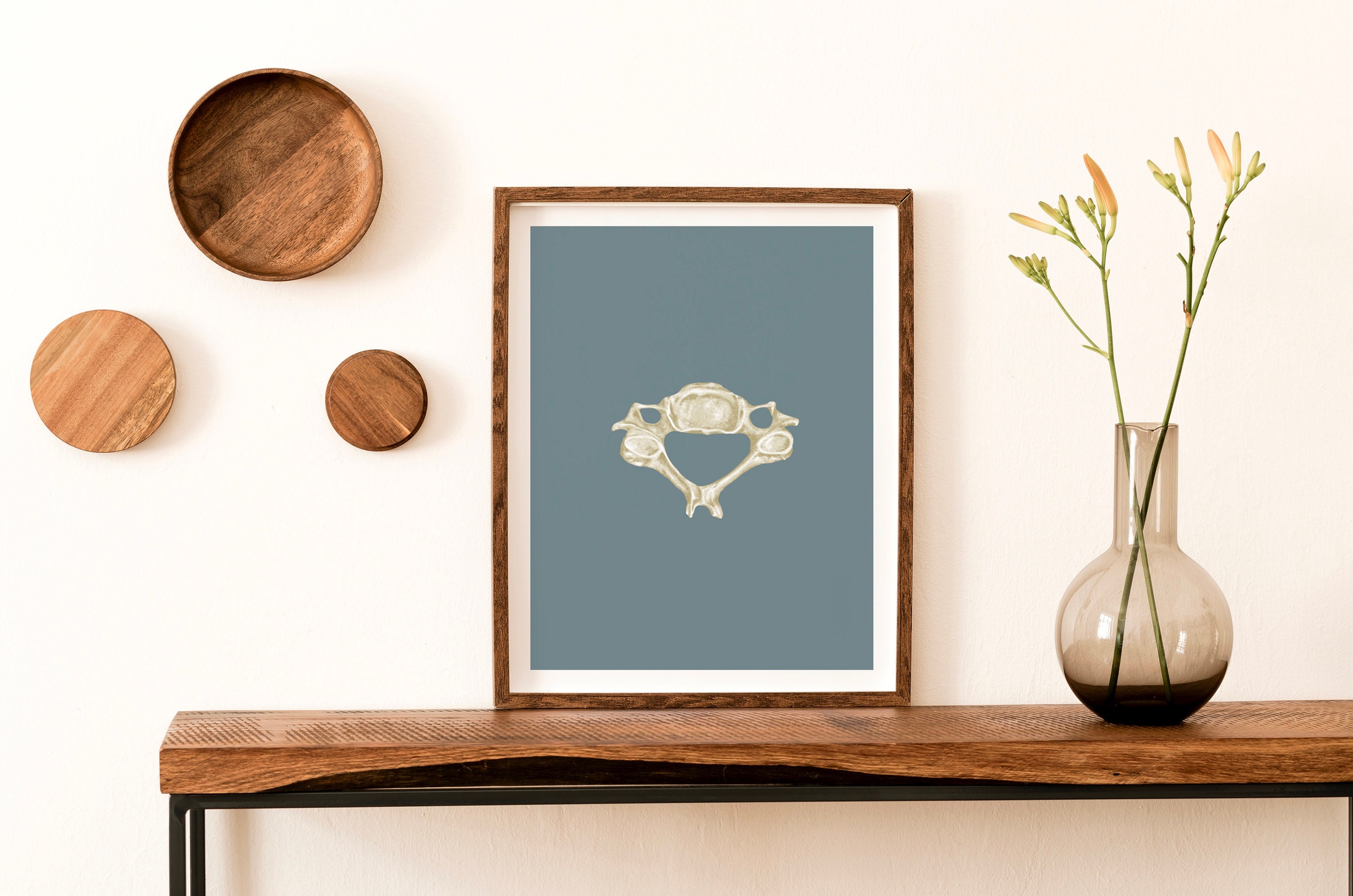 Cervical Vertebrae Drawing Print Download - Etsy