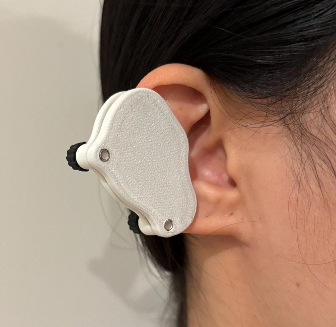 Ear Keloid Compression Earring - After Surgery Keloid Treatment ...