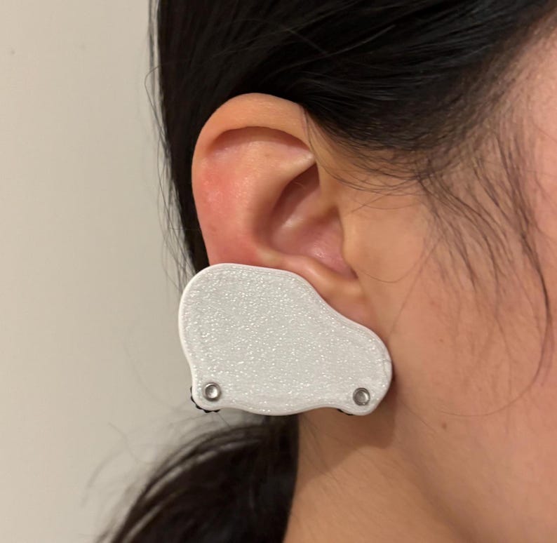 Ear Keloid Compression Earring - After Surgery Keloid Treatment ...