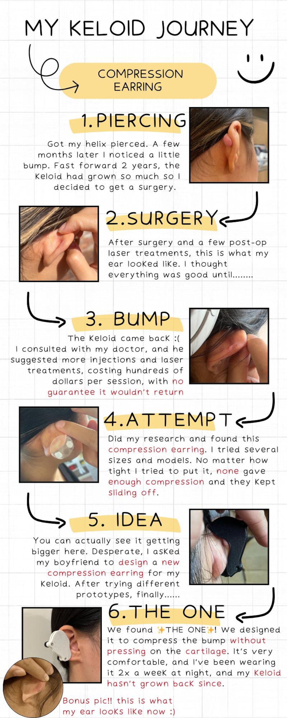 Ear Keloid Compression Earring - After Surgery Keloid Treatment ...