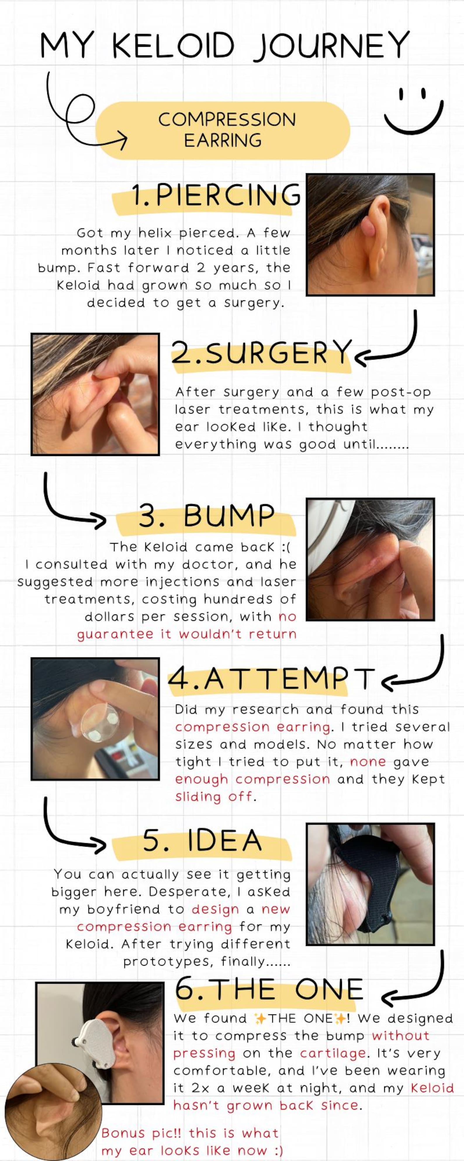 Keloid Compression Earring – Post-surgery Earlobe Treatment Strong Hold ...