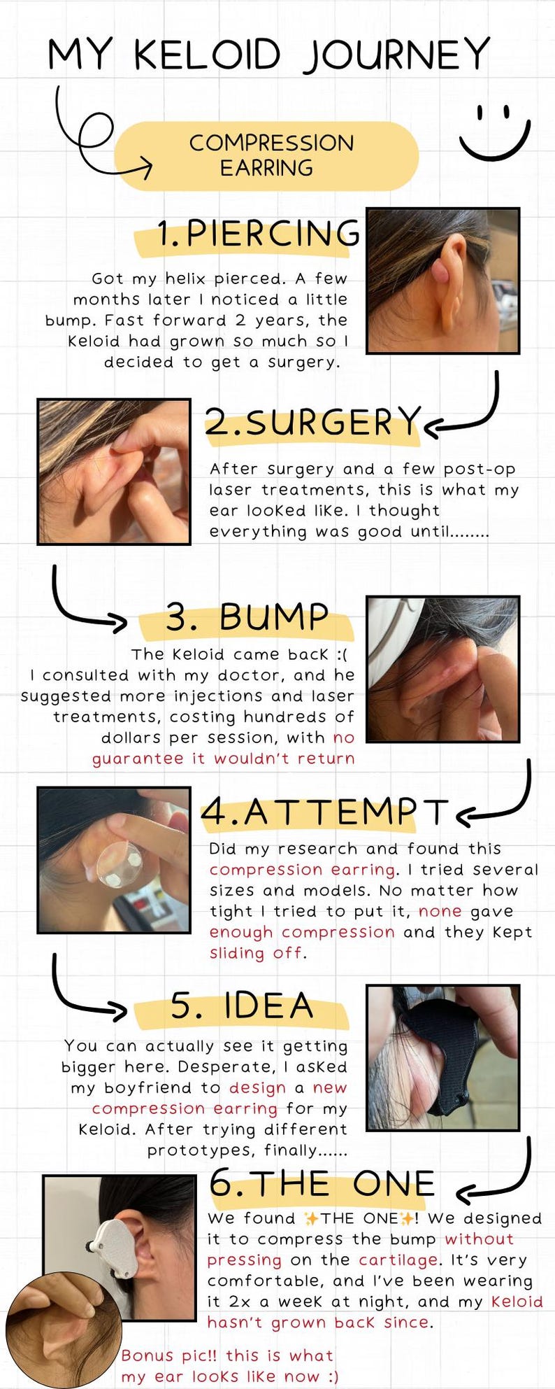 Ear Keloid Compression Earring - After Surgery Keloid Treatment ...