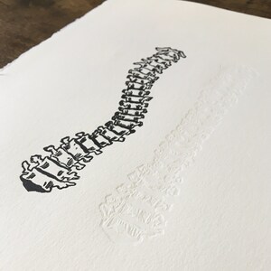 Spine and Scoliosis, Art Print, Limited Edition, Linocut, Handmade ...