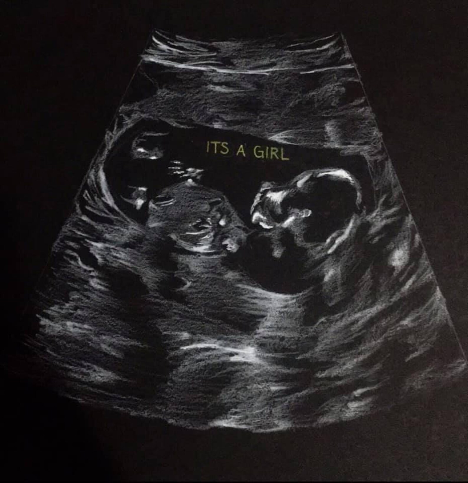 Ultrasound Drawing or Painting - Etsy