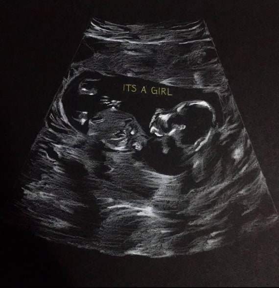 Ultrasound Drawing or Painting | Etsy