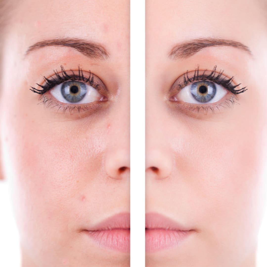 Concealers - Corrector Mint, Corrector Brighten-up & Concealer Lilac ...