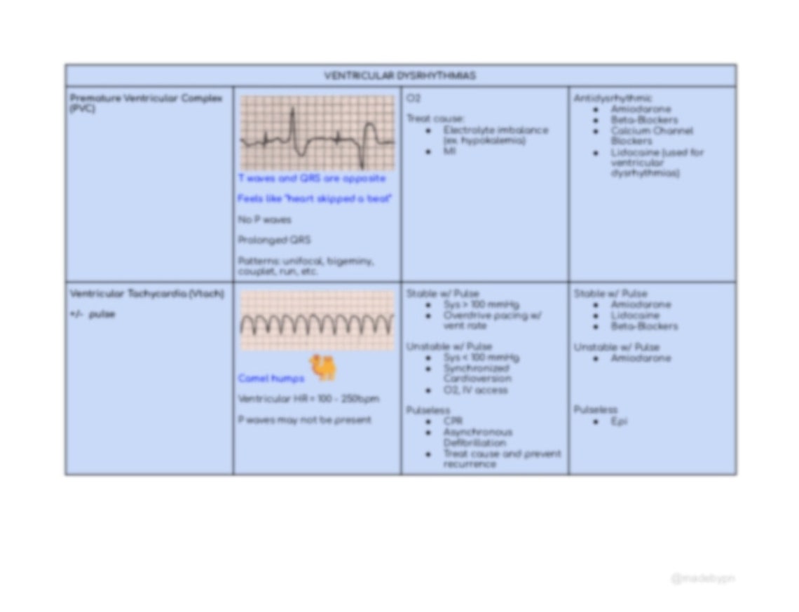 Quick & Easy EKG Study Guide for Nursing Students - Etsy