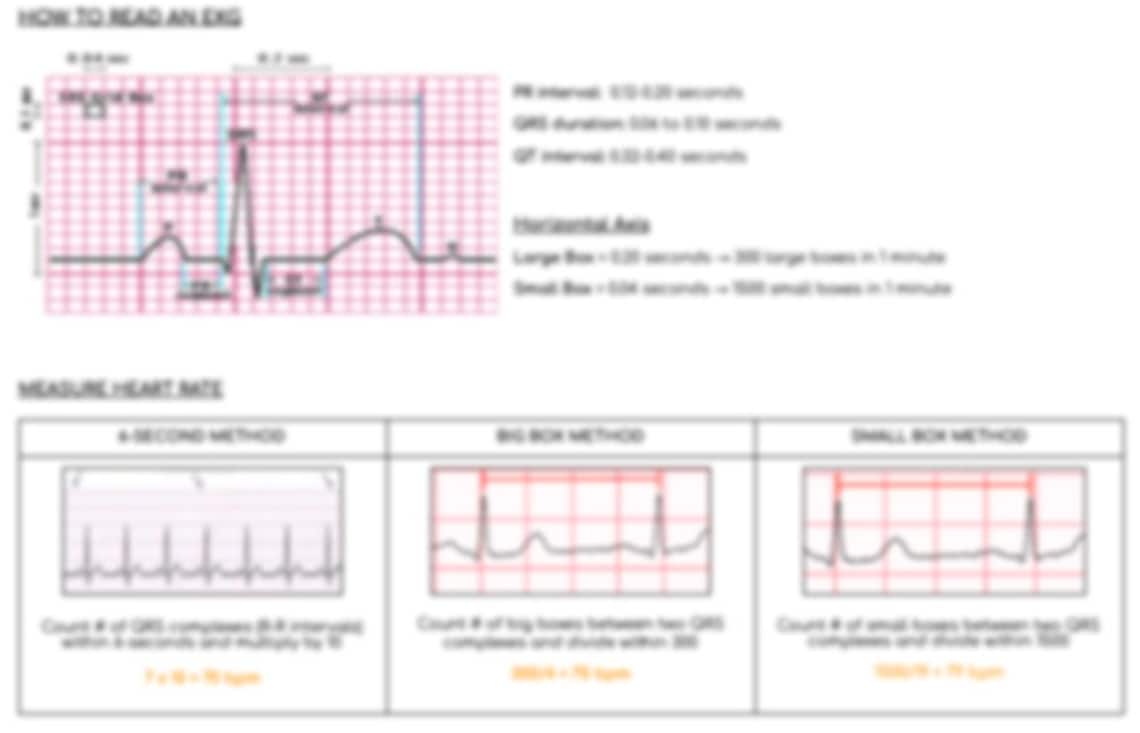 Quick & Easy EKG Study Guide for Nursing Students - Etsy