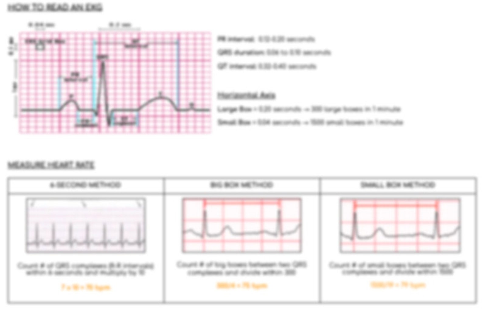Quick & Easy EKG Study Guide for Nursing Students - Etsy