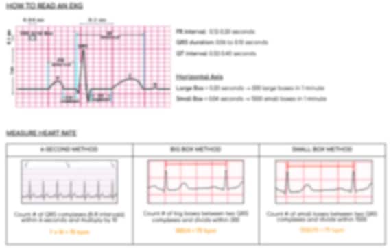 Quick & Easy EKG Study Guide for Nursing Students - Etsy