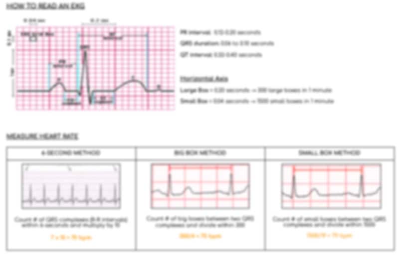 Quick & Easy EKG Study Guide for Nursing Students - Etsy