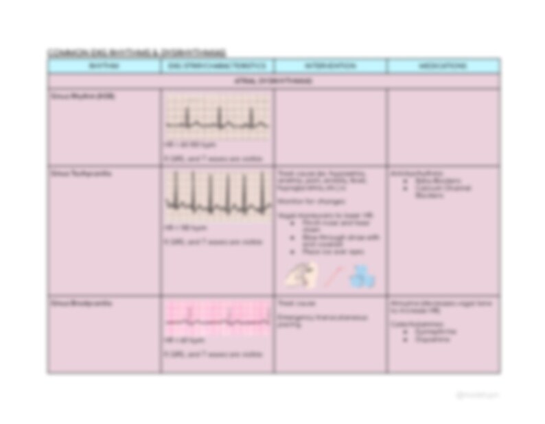 Quick & Easy EKG Study Guide for Nursing Students - Etsy