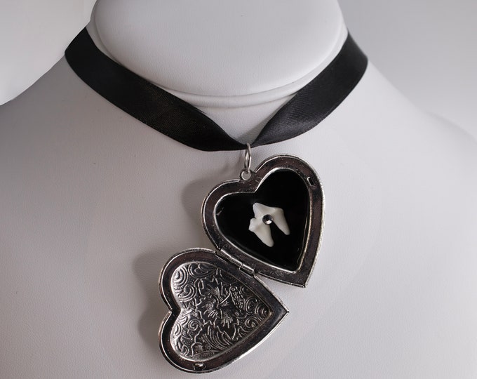 Loose Tooth Locket Ring - Etsy