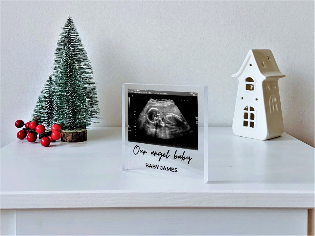 Baby Scan Photo - Pregnancy Announcement, New Baby Scan Gift ...