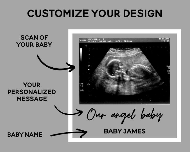 Baby Scan Photo - Pregnancy Announcement, New Baby Scan Gift ...
