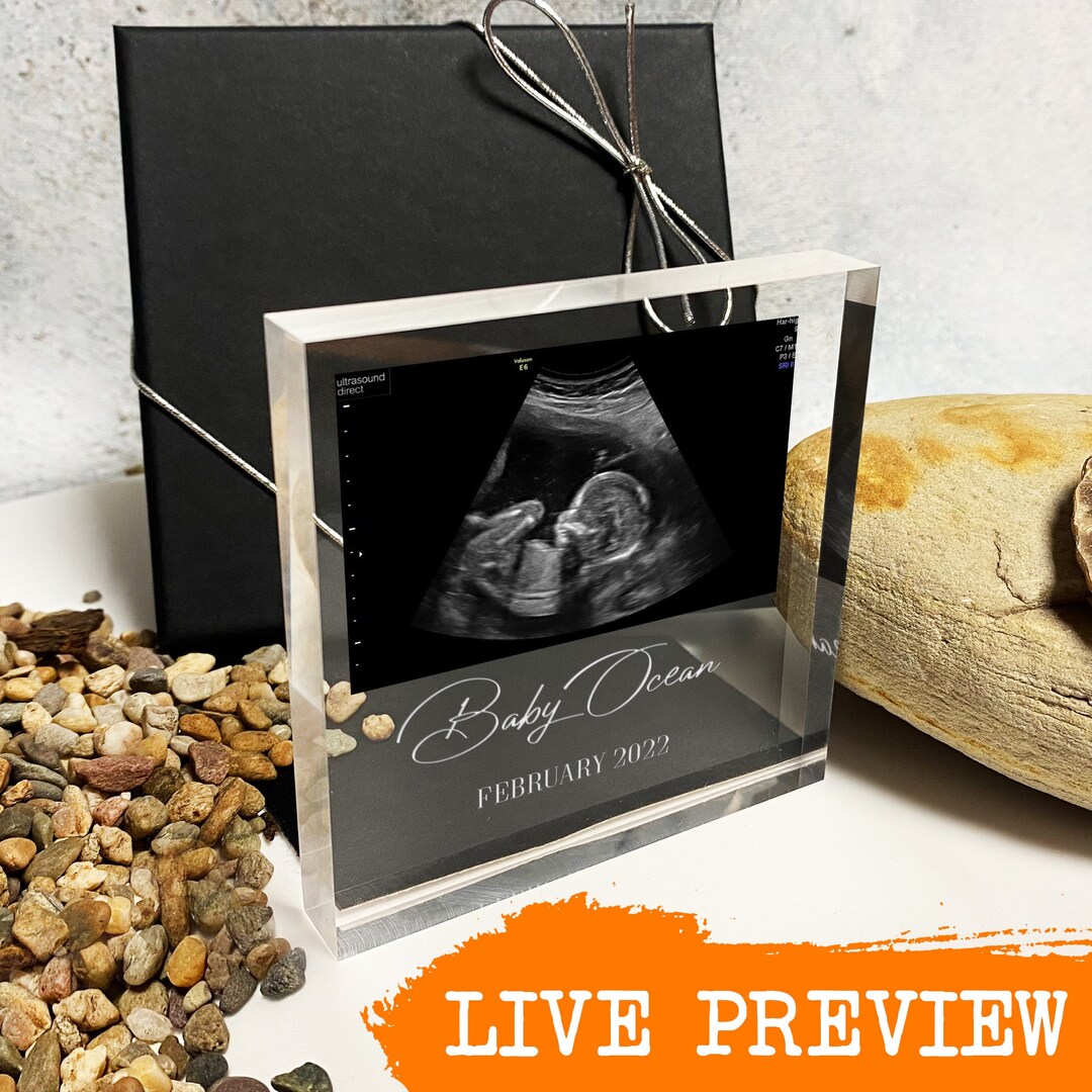 Personalised Baby Scan Photo | Baby Scan Frame | Baby Scan Gift ...