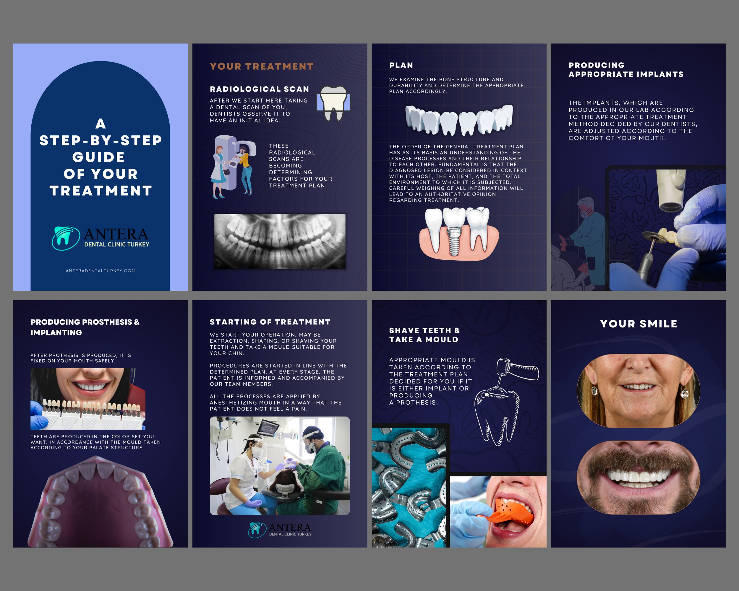 Dental Treatment Information Flyer Digital Download Root Canal Fillings ...