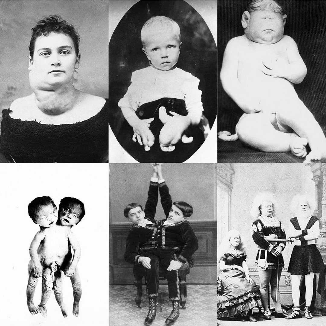 Weird Deformities Medical Scary Strange Photo Vintage Odd - Etsy