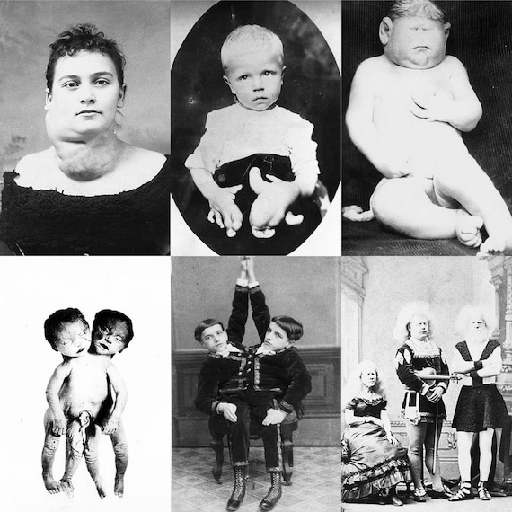 Weird Deformities Medical Scary Strange Photo Vintage Odd - Etsy