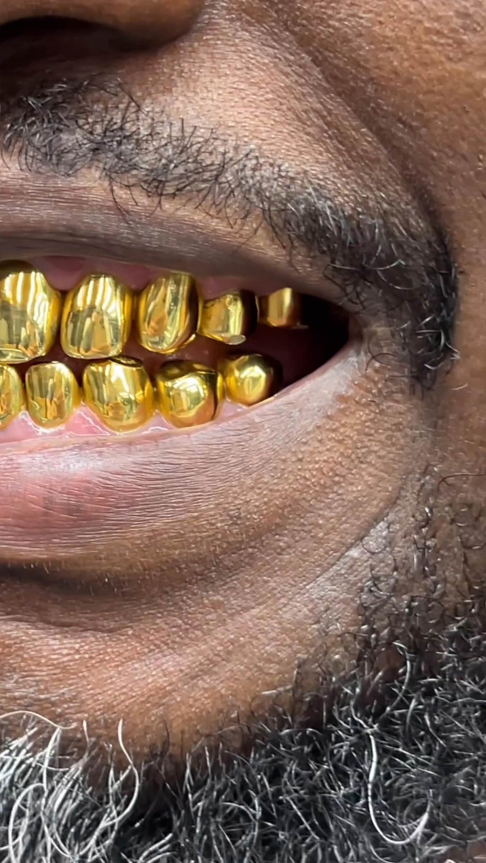 Solid Gold Grillz Perm Cut Grillz Permanent Looking Grillz - Etsy UK