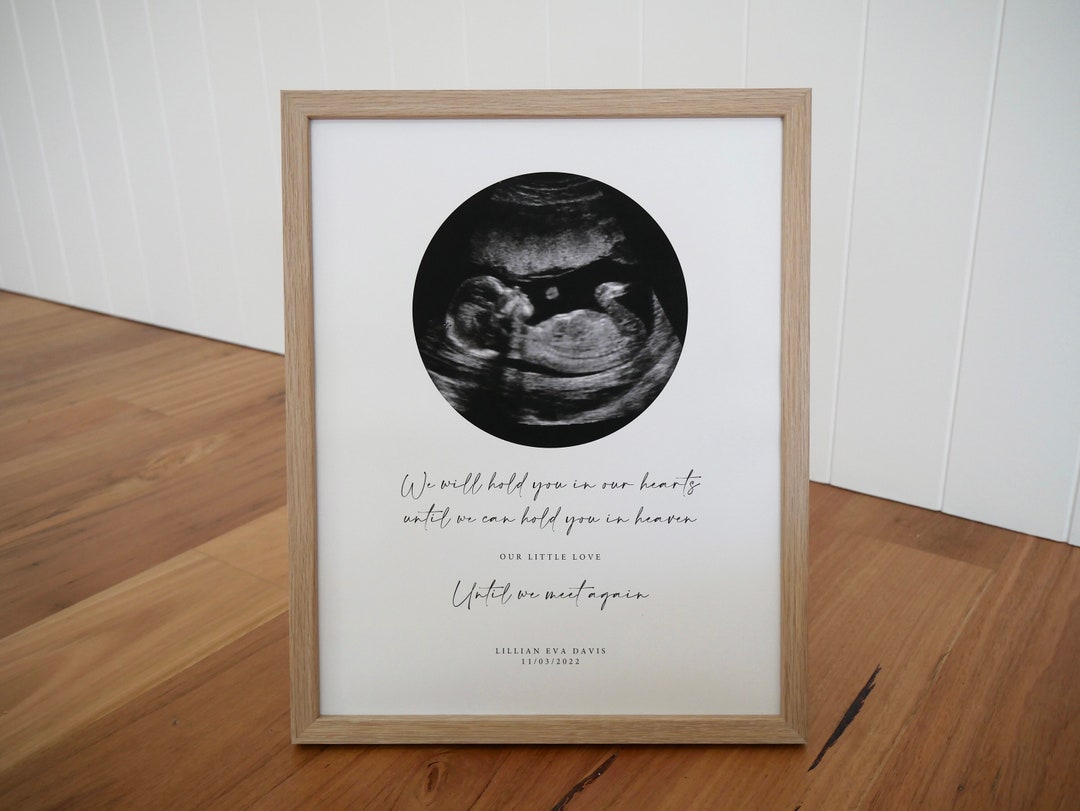Miscarriage Keepsake Baby Loss Gift Miscarriage Gift Infant Loss ...