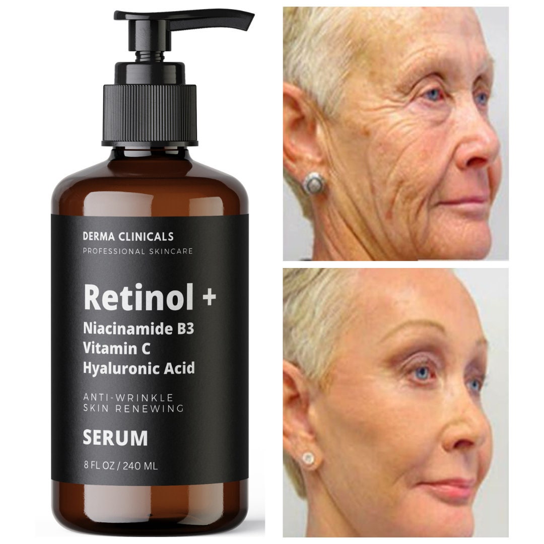 Retinol And Vitamin C Serum Discount Cityofclovis Retinol And Vitamin C Serum Discount Cityofclovis