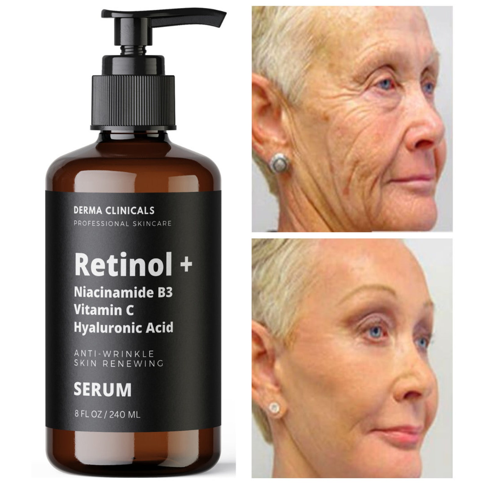 Retinol Serum Niacinamide , Vitamin C & Hyaluronic Acid , Botox Wrinkle Remover Anti-aging Face ...