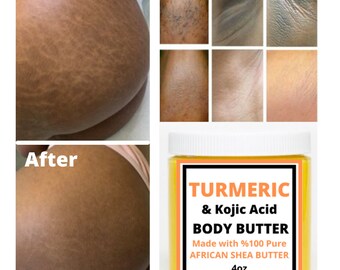 Inner Thigh Cream - Etsy