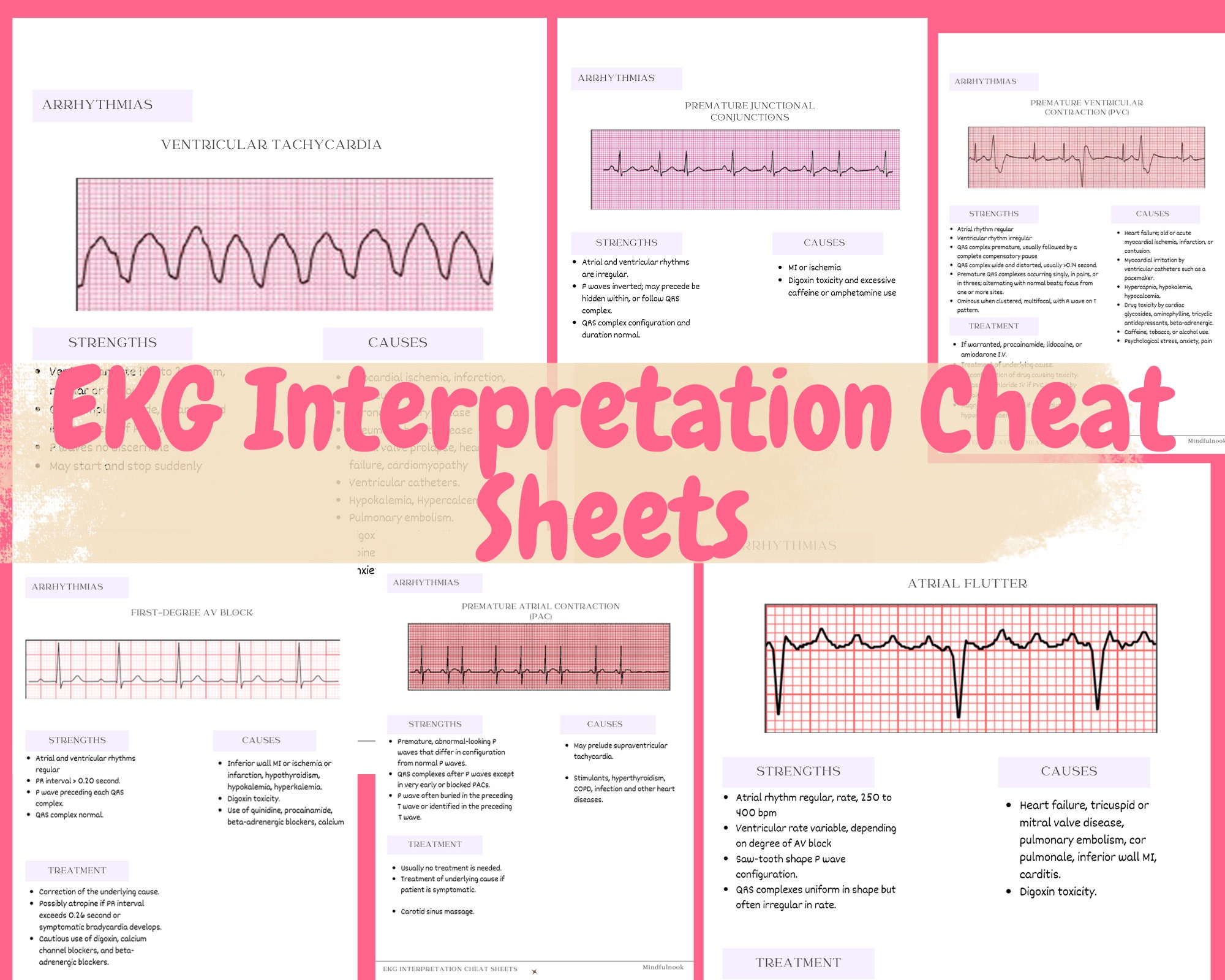 Ecg Interpretation Vrogue co Ecg Interpretation Vrogue co