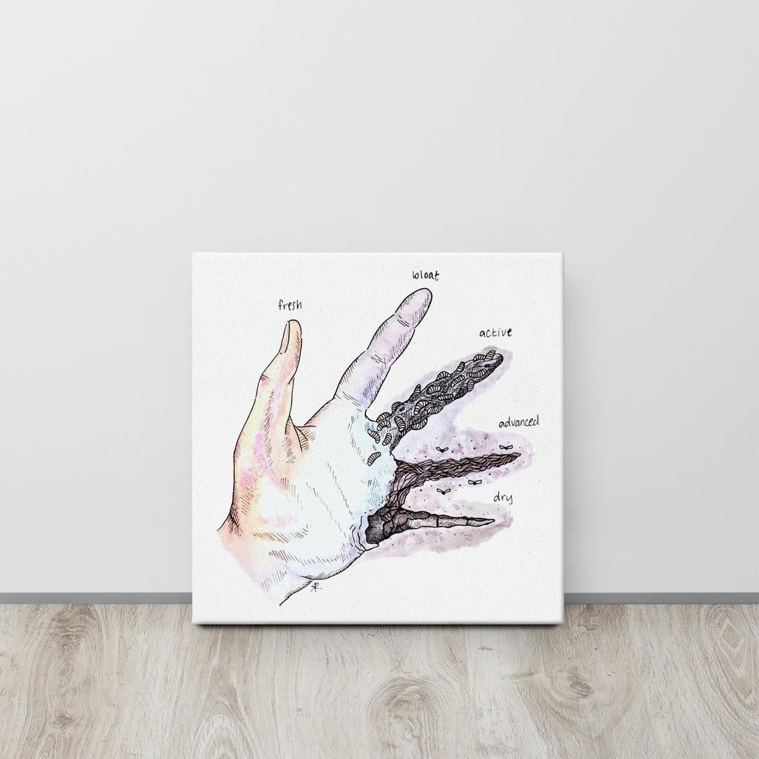 Stages of Decay Hand Thin Canvas Print - Watercolor & Ink - Pathology ...