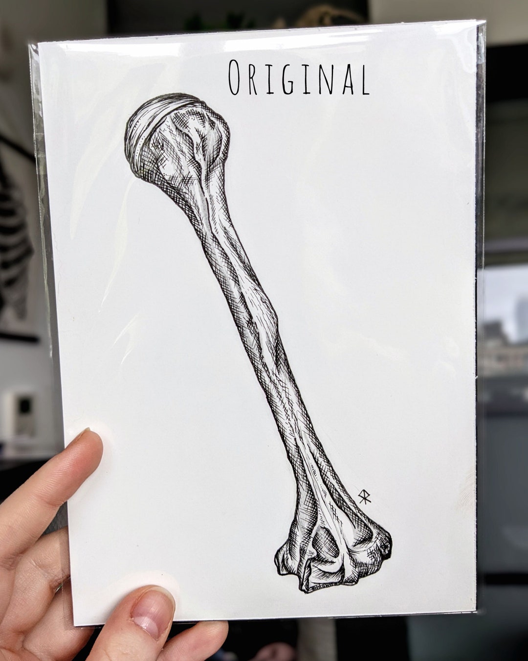 Humerus Original by Skye Rain Art Anatomic Illustration Black Ink ...