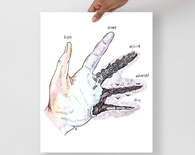 5 Stages of Decay Hand - Human Decomposition - Forensic Science ...